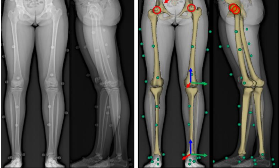 Open Position at the Gait Lab! | Department of Biomedical Engineering ...