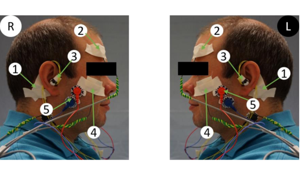 News details | Department of Biomedical Engineering | University of Basel