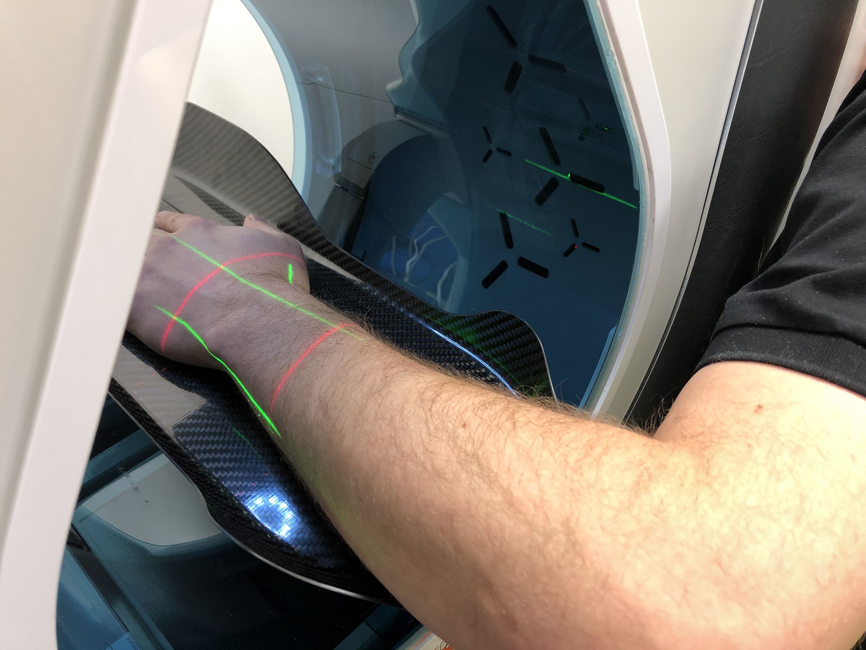 Hand Surgery | Department of Biomedical Engineering